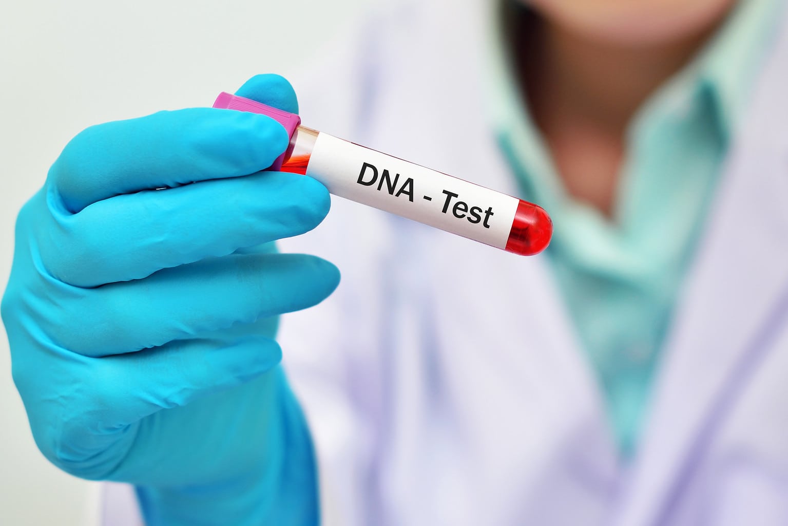4 Tips for Choosing the Best DNA Test for Your Needs